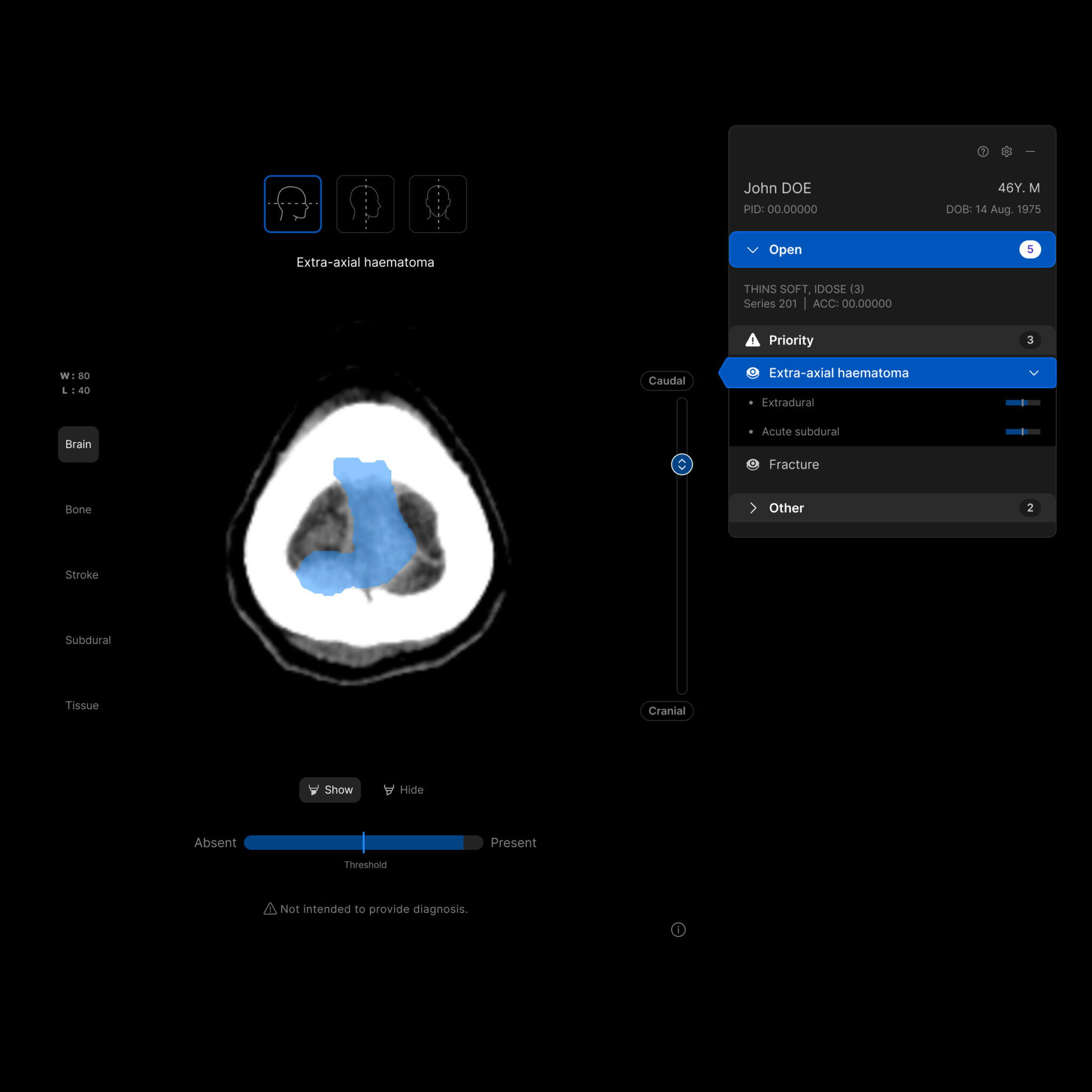 Harrison.ai | Medical imaging AI tools