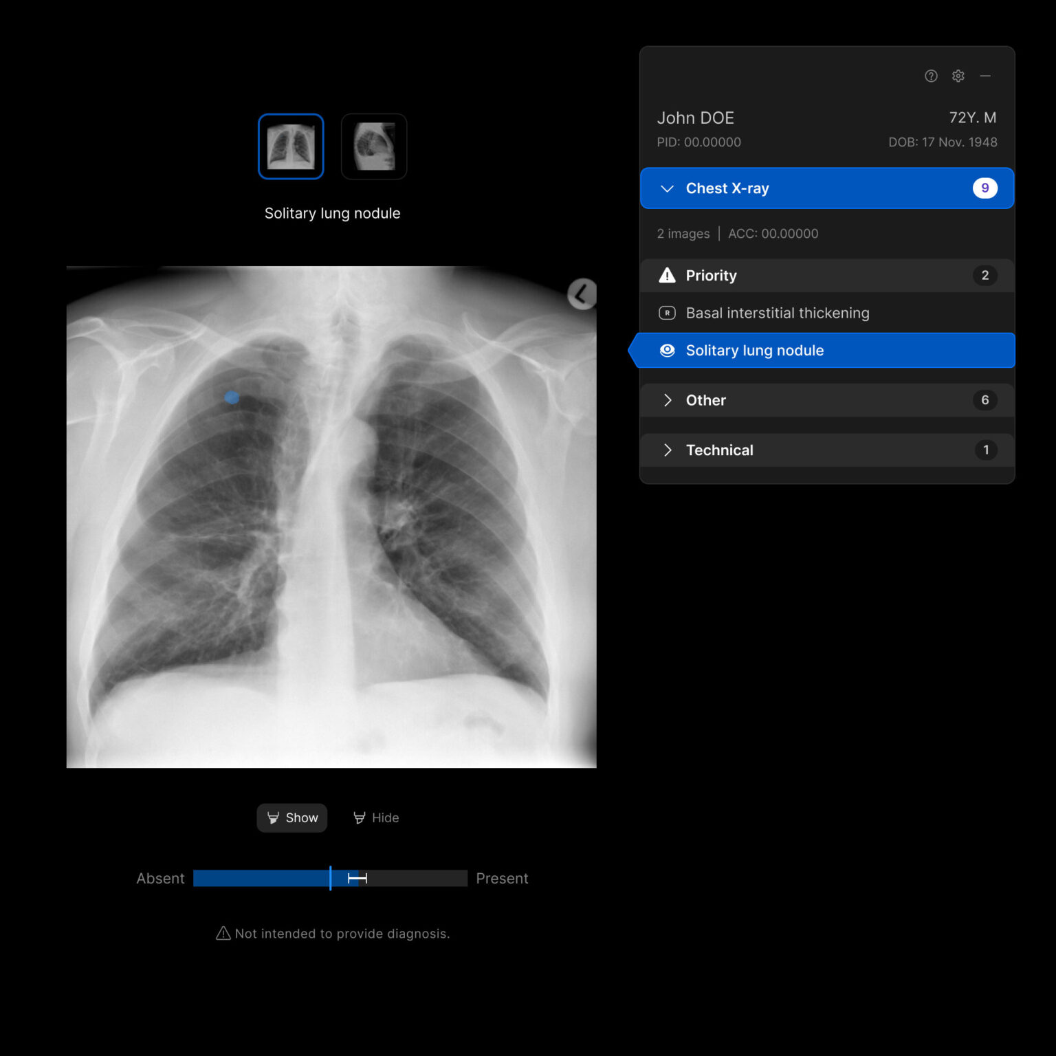 Harrison.ai | Medical imaging AI tools