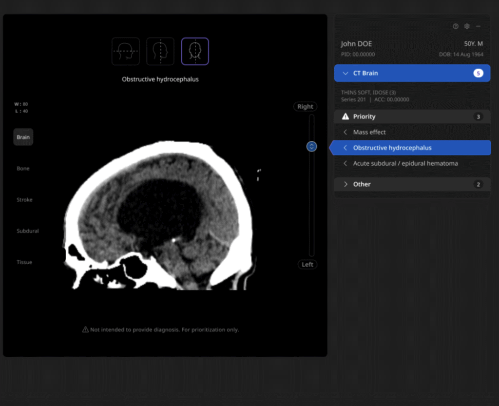 Harrison.ai | Global Leader in AI-Powered Radiology & Medical Imaging