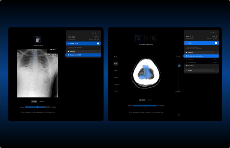 About Harrison.ai — Pioneering AI in Radiology & Medical Imaging