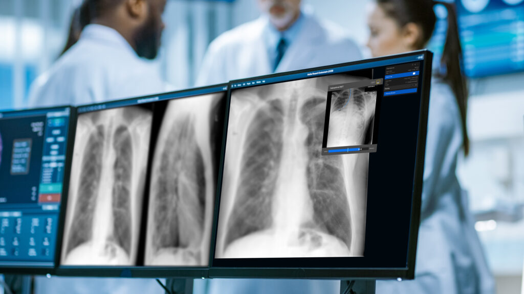 Radiologist reporting productivity benefits from AI-assisted triage of ...