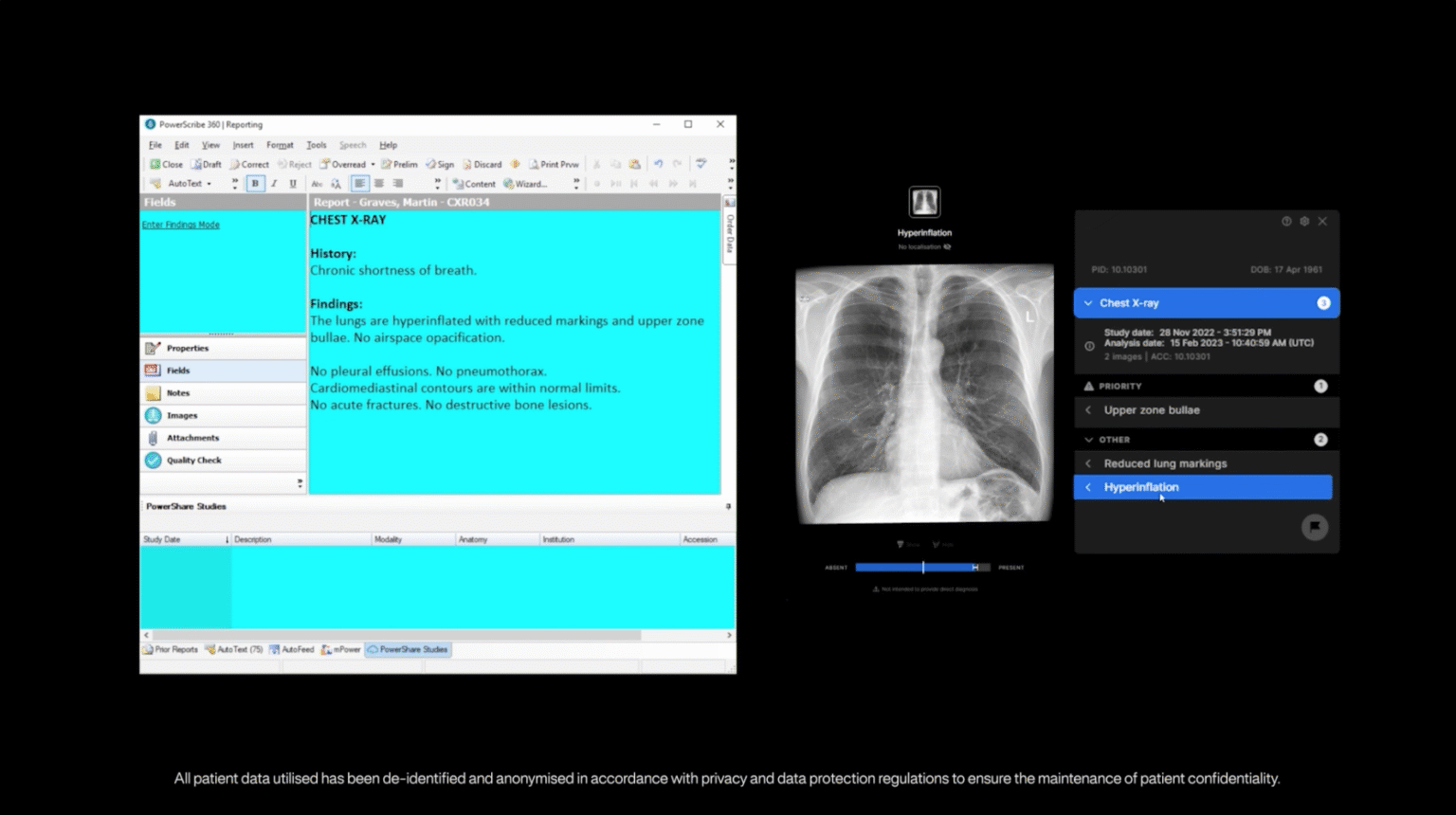 Harrison.ai Draft Report Generation: Driving Innovation in Radiology AI ...