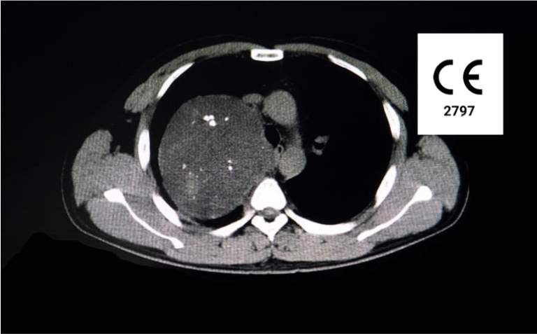 Harrison.ai ECR 2026