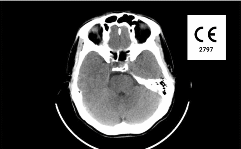Harrison.ai ECR 2026